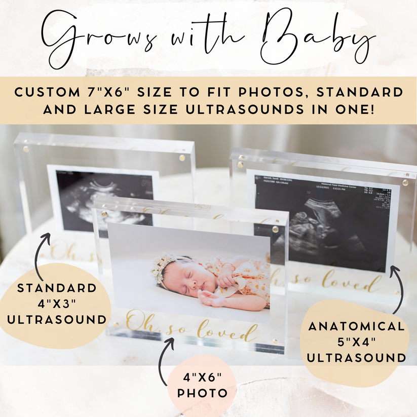 Ultrasound Picture Frames – MAMA loves MINI
